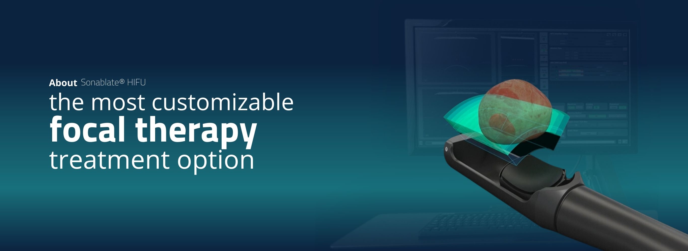 Sonablate HIFU | Sonablatecorp